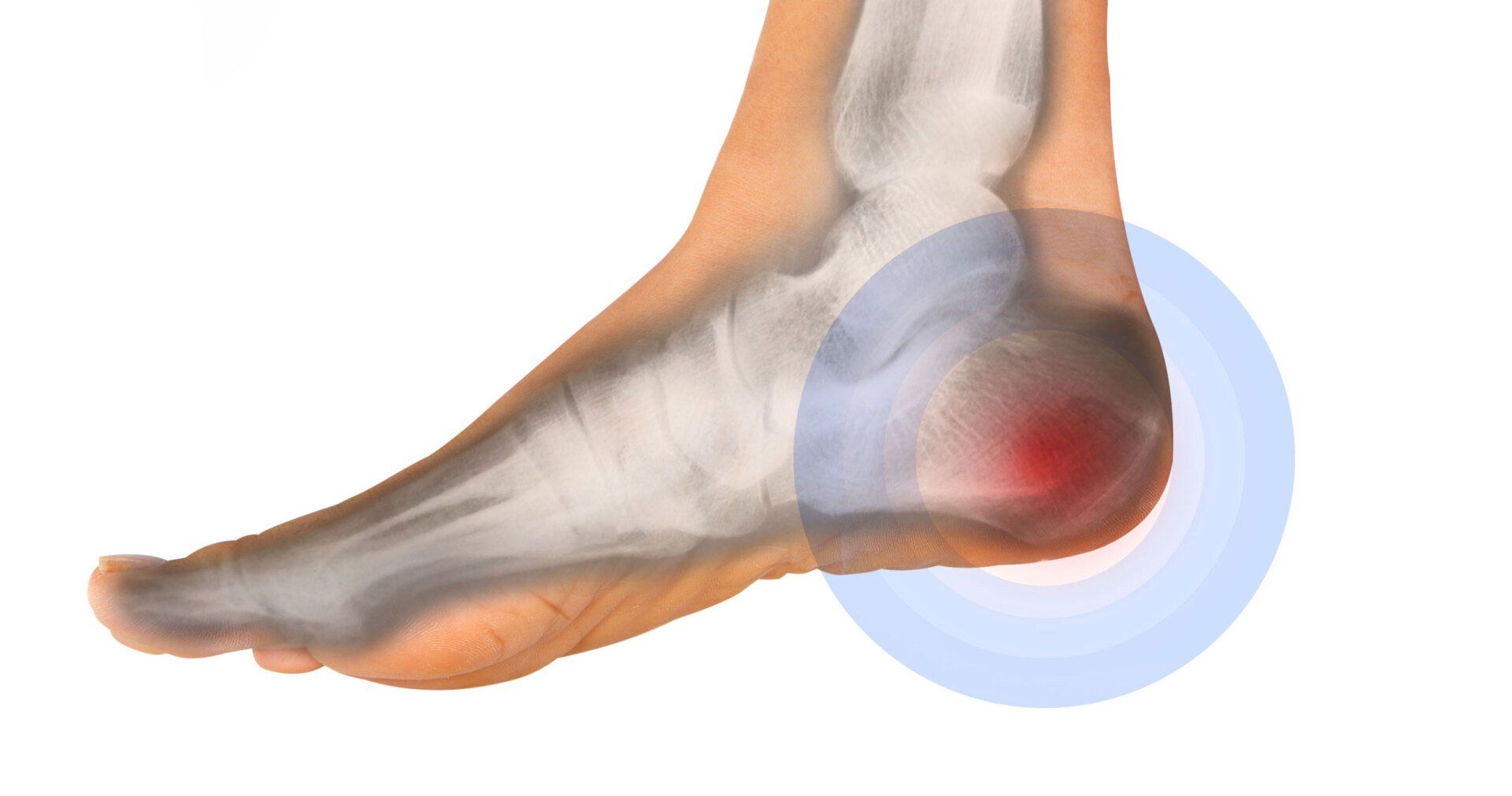 James M. Haggerty DPM | Podiatry Services | Dunmore, PA