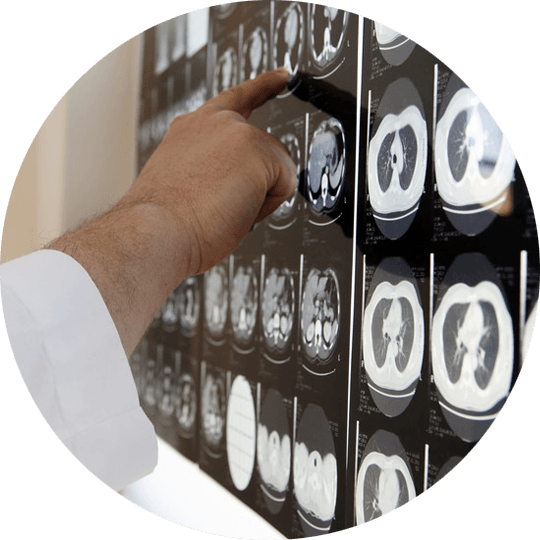 Excel Imaging Center | MRI | Garden Grove, CA