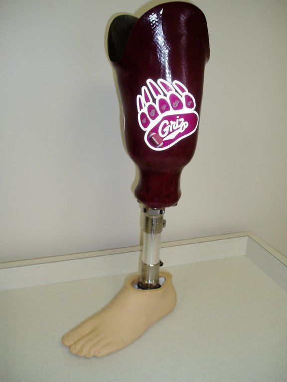 Rimrock Prosthetics | Prosthetic Services | Billings, MT