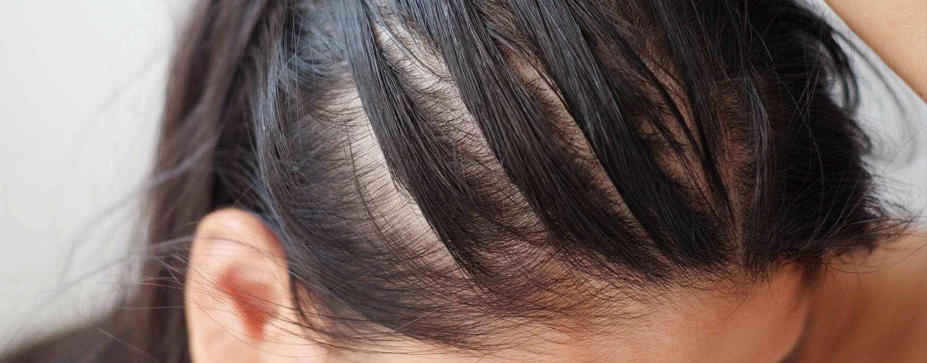 Scalp Care | Ashido Hair & Scalp Salon | Montclair, CA