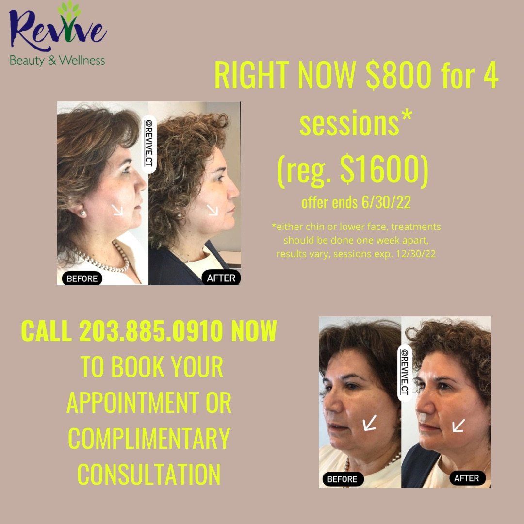 Revive Beauty & Wellness | Medical Spa | Brookfield, CT